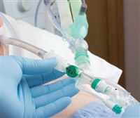 TrachSeal™ closed suction systems for 72 hour use